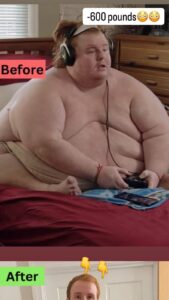 Casey King’s Weight Loss of over 600 lbs: How Bariatric Surgery Helped ...