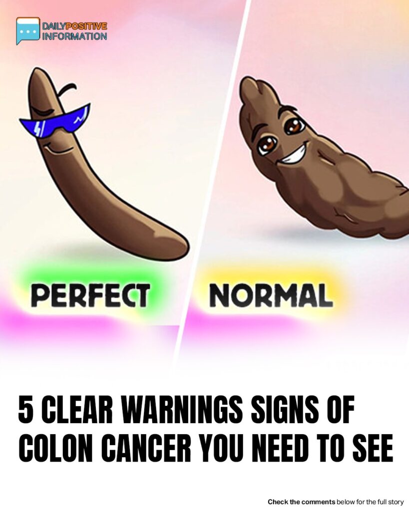 Doctors Urge Everyone To Watch For These 5 Early Signs Of Colon Cancer ...
