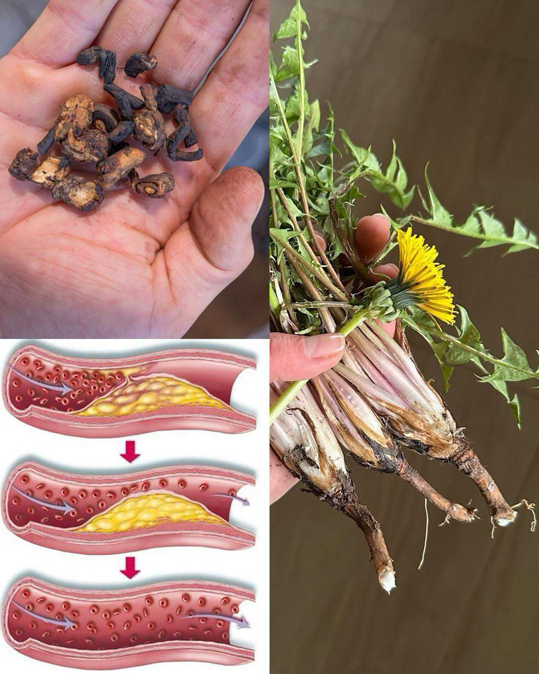 Dandelion Root Coffee: 20 Benefits & How to Make It at Home – TREND HUB ...