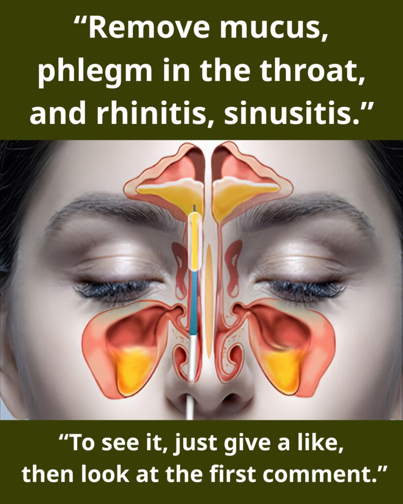 Clear Mucus, Phlegm, and Nasal Congestion Fast: Effective Home Remedies ...